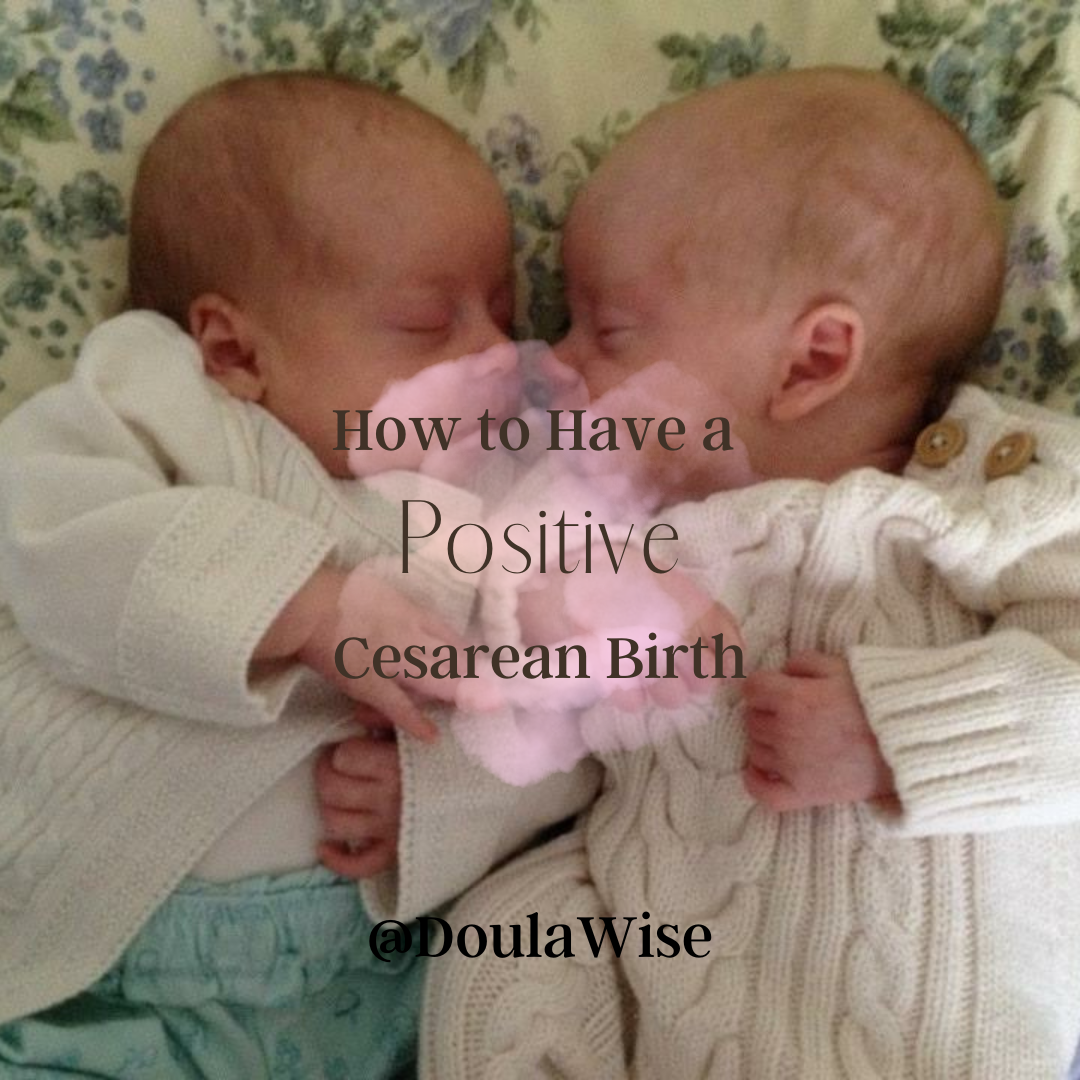 Positive Cesarean Birth – DoulaWise